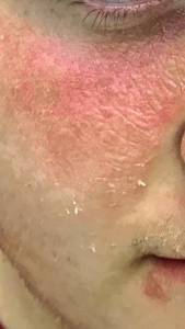 State to remediate creosote problem on Royalton bridge - VTDigger